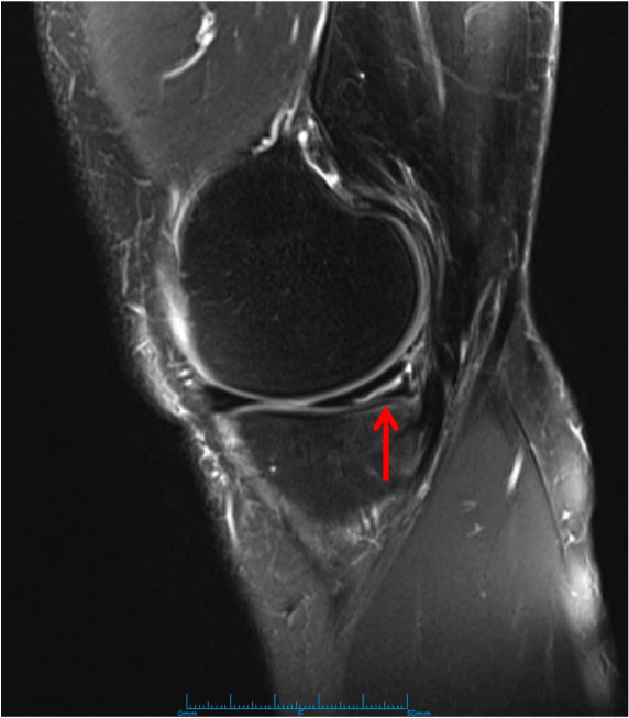 Knee News Mark Snell Com