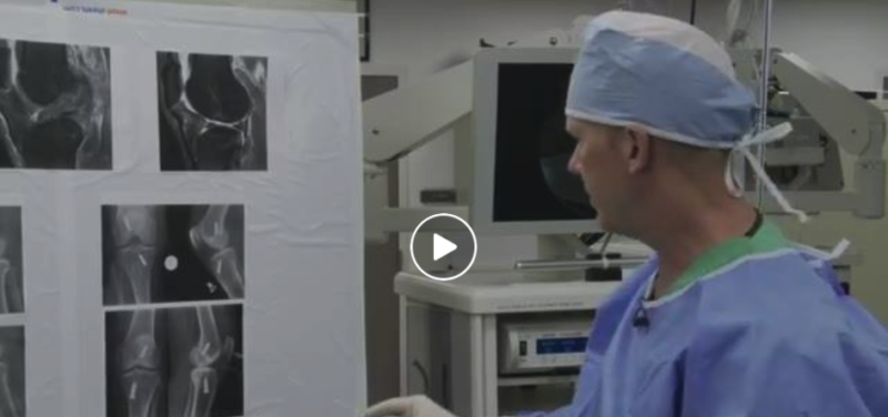 Robert LaPrade, MD | Minnesota Knee Specialist | Twin Cities ...